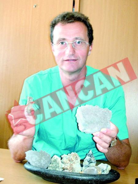 Colectioneaza pietre din rinichi