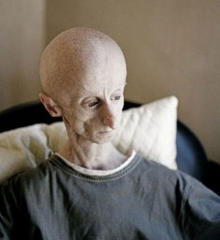 INCREDIBIL! Omul-Extraterestru traieste in Africa si are 25 de ani!