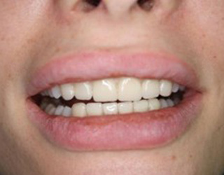 Brigitte Sfat, zambet de mii de euro...la propriu! Uite ce dinti ...