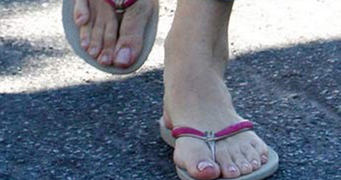 Dive sexy? Uite ce picioare urate au unele dintre cele mai frumoase ...