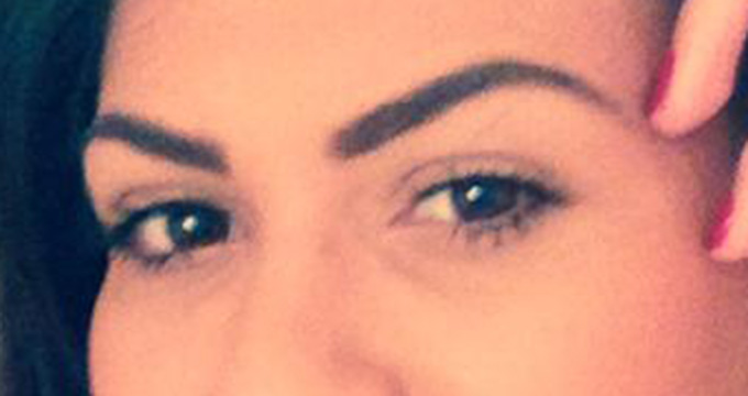 "Prea mult botox in dreapta sus". Ce vedeta de la noi s-a "tunat" in ...