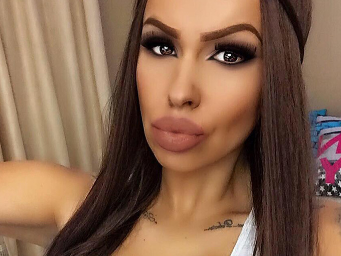 Primele imagini cu ”Spintecătoarea de la morgă” după ce şi-a operat nasul