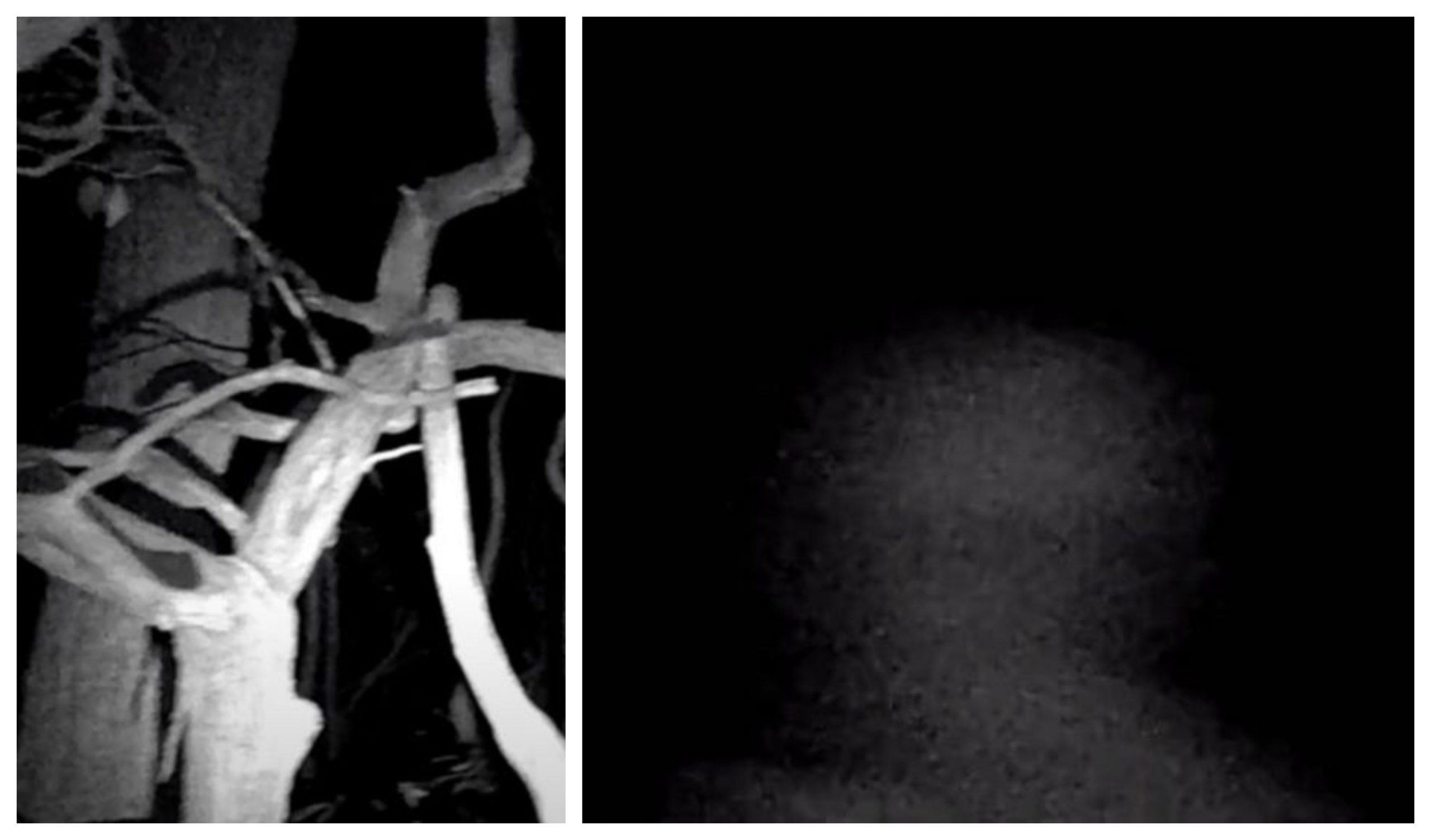 O posibilă fantomă, filmată într-o pădure din SUA. Imagini ...