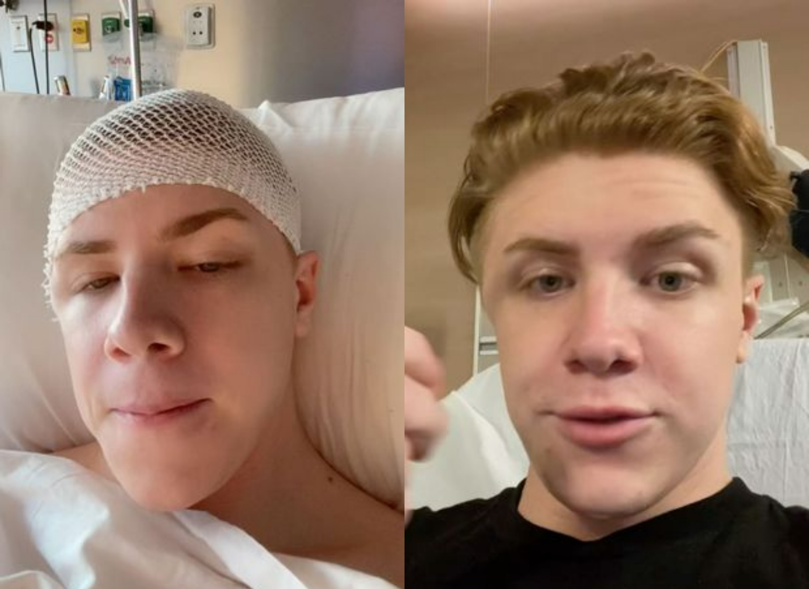 A plecat de acasă pe skateboard și s-a trezit la spital fără jumătate ...