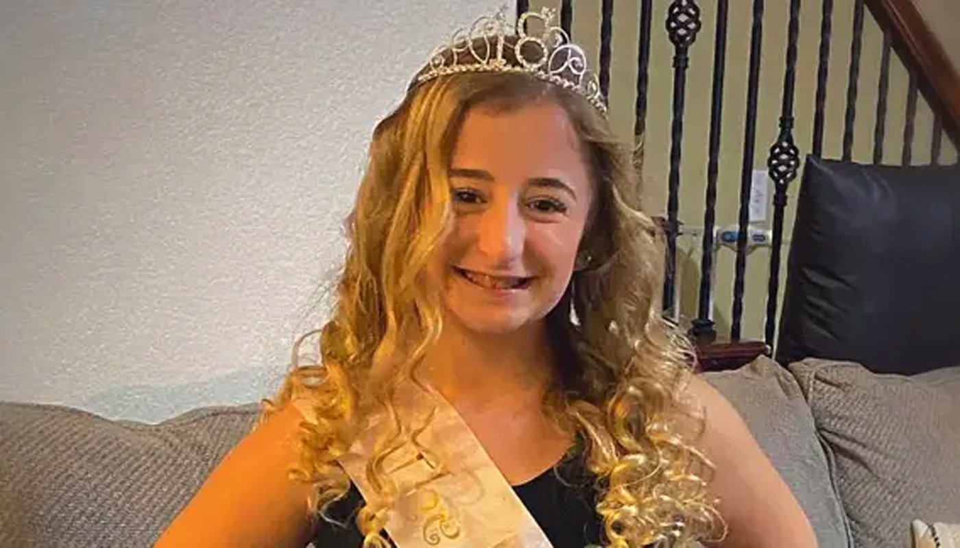 Tânăra din imagine s-a născut cu "dinți transparenți". Ce înseamnă și ...