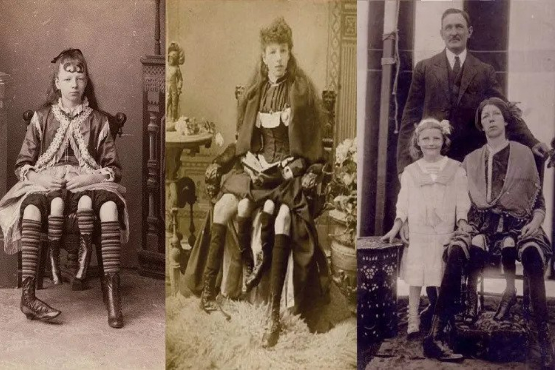 Cazul care a uimit o lume întreagă. Cine este Josephine Myrtle Corbin ...