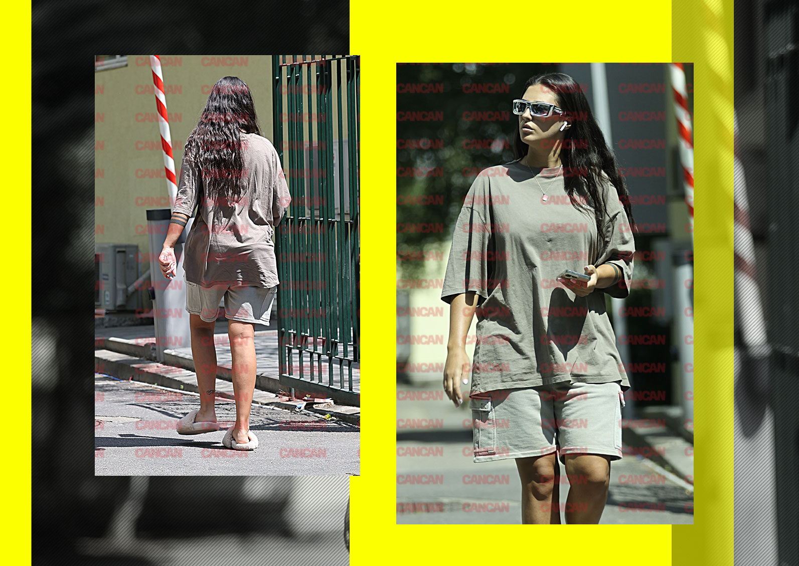 Antonia abordează stilul "miserupist" și se mândrește cu a sa foliculită