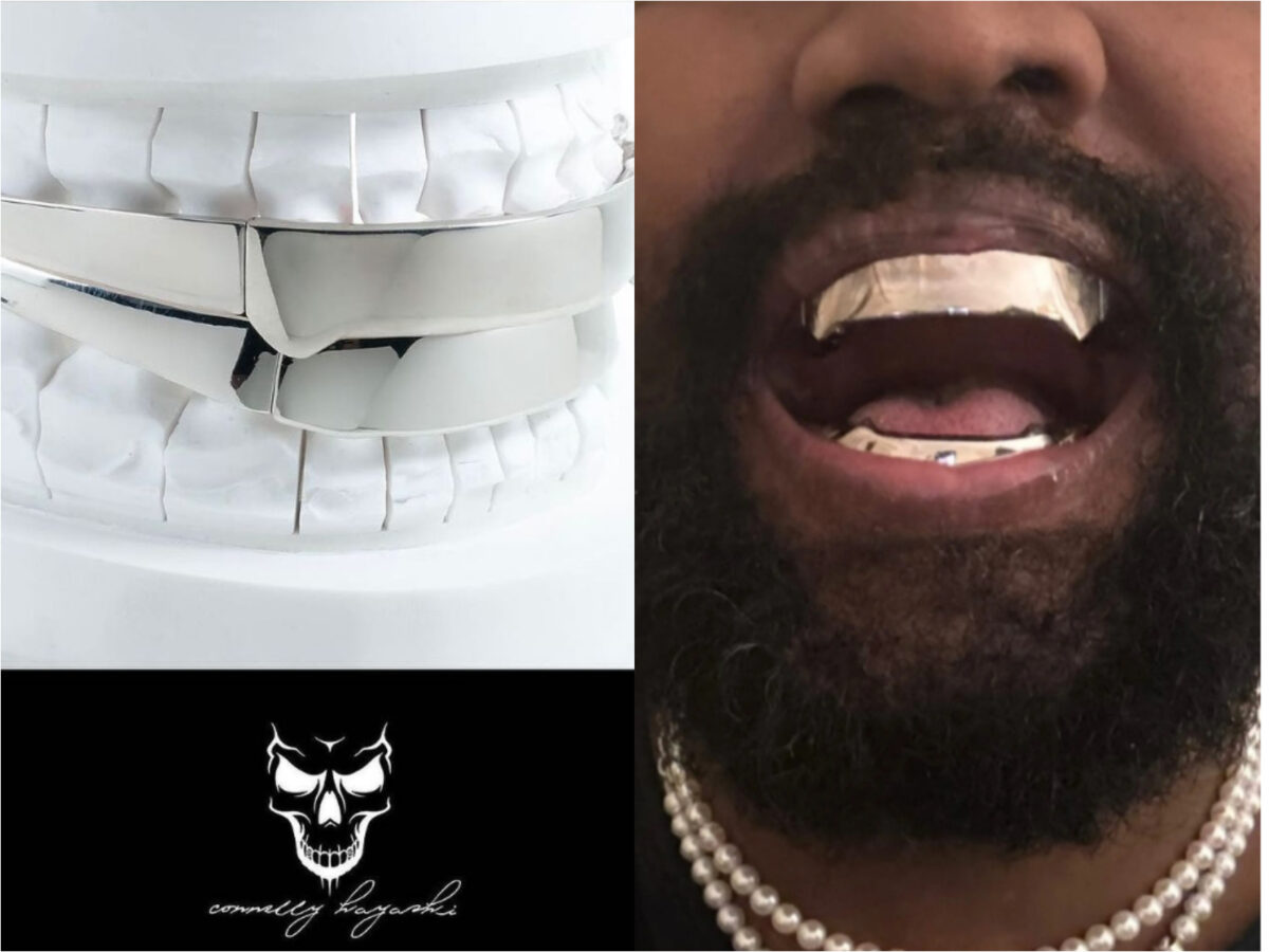 Kanye West și-a înlocuit toți dinții cu proteze de titan, în valoare de ...