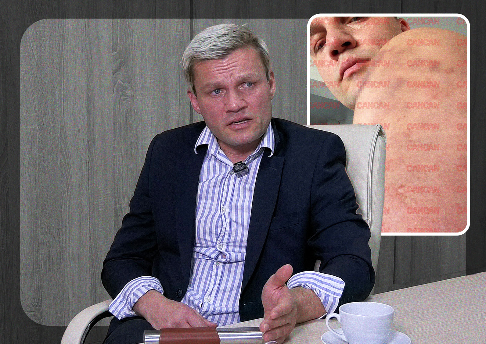 Super-modelul Andre Bîrleanu rupe tăcerea, după acuzațiile fostei ...